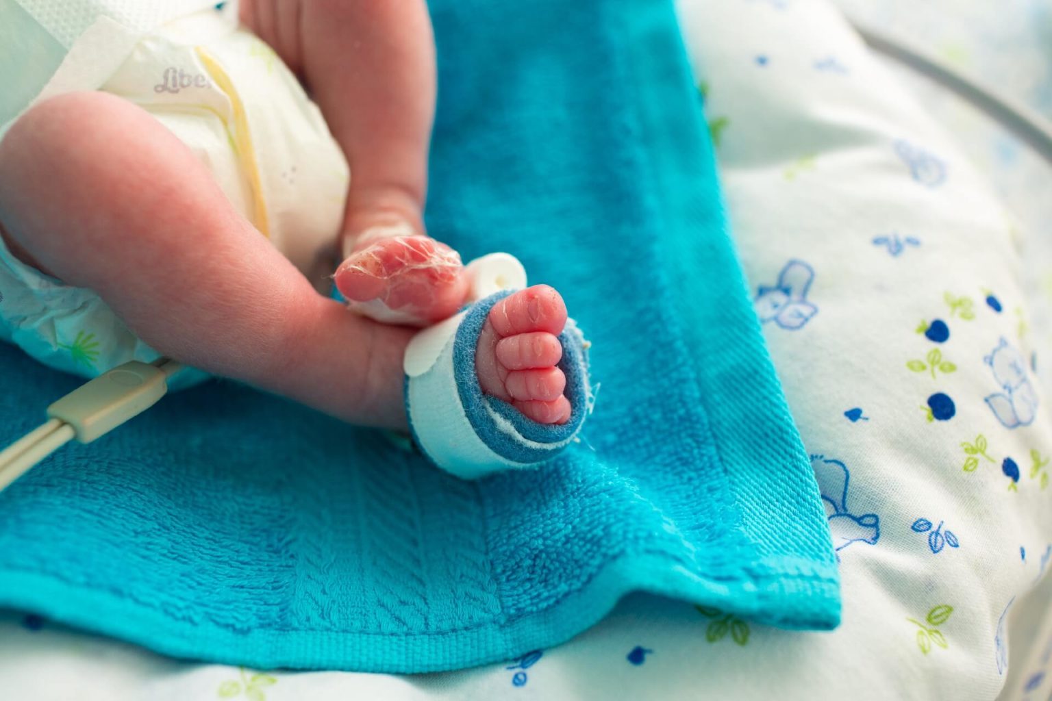 Triagem neonatal e a importância do diagnóstico precoce